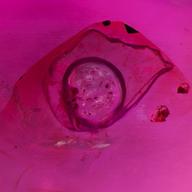 Ruby fissures and bubble